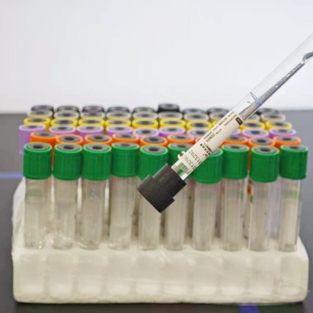 7ml 8ml Sodium Citrate ESR Tube With Screw Cap Green Top Lithium ...